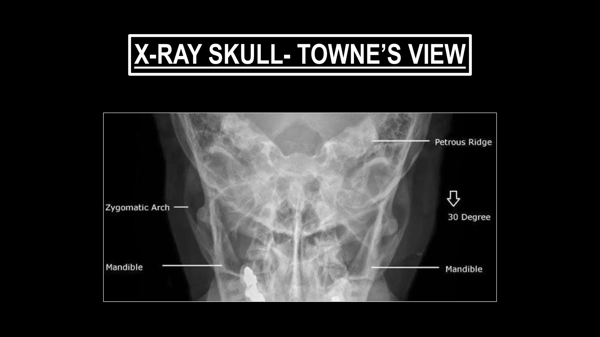 ENT X-RAYS | PPTX