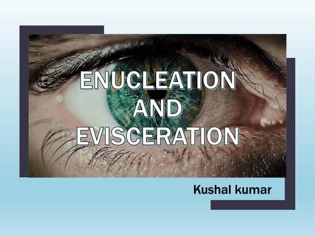 Enucleation and evisceration | PPTX | Eye and Vision Conditions ...