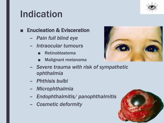 Enucleation and evisceration | PPTX | Eye and Vision Conditions ...