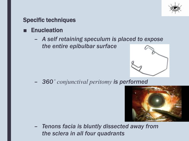 Enucleation and evisceration | PPT