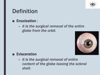 Enucleation And Evisceration: What To Expect, 52% OFF