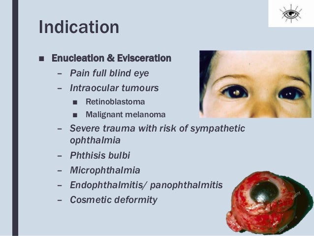 Enucleation and evisceration