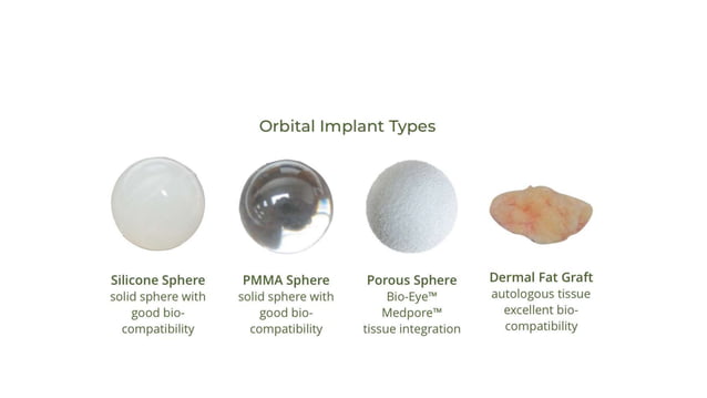Enucleation, evisceration, exenteration | PPTX | Eye and Vision ...