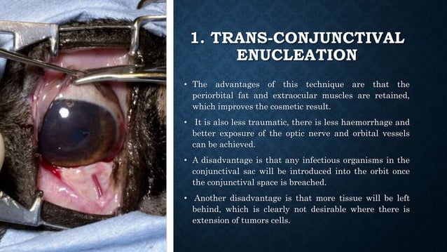 Enucleation of eye | PPTX | Eye and Vision Conditions | Diseases and ...