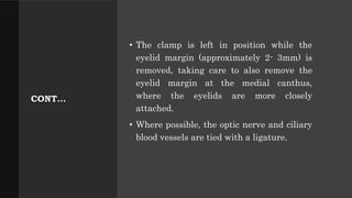 Common Causes Of Eye Enucleation Among Patients – YLEAV