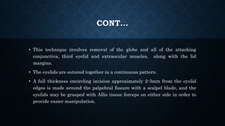 Enucleation of eye | PPTX