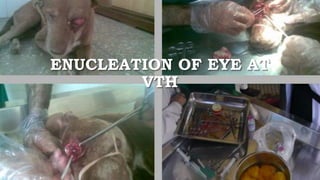 Enucleation of eye | PPTX