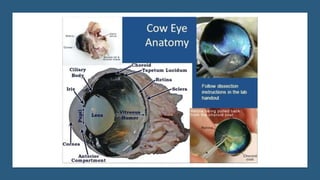 Enucleation of eye | PPTX