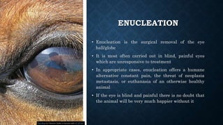 Enucleation Of The Eye