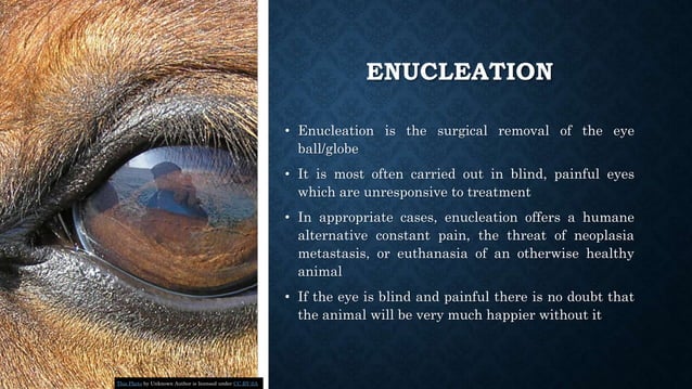 Enucleation of eye | PPT