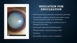 Enucleation Of The Eye
