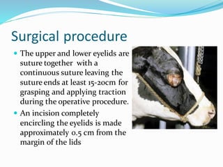enucleation of eye (2).pdf