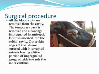 enucleation of eye (2).pdf