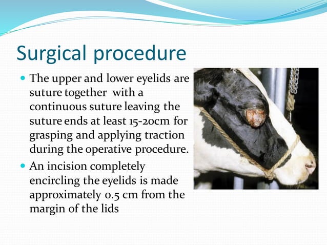 enucleation of eye (2).pdf