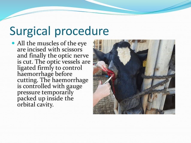 enucleation of eye (2).pdf