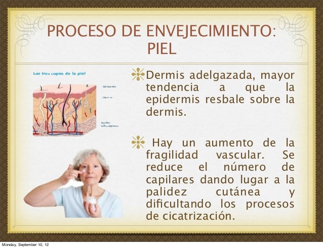Envejecimiento por aparatos y sistema Envejecimiento por aparatos y sistema