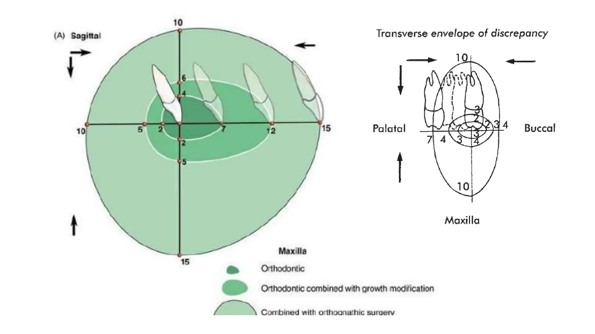 Envelope of Discrepancy in Orthodontics: Enhancing Precision in ...