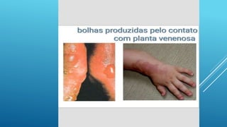 Envenenamento slides | PPTX