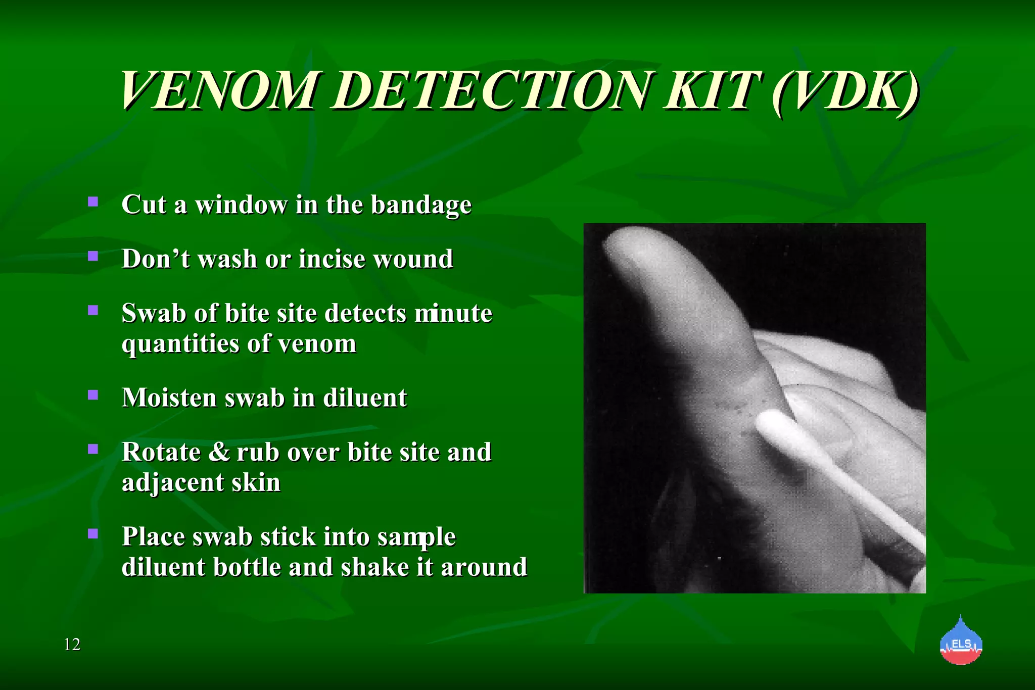 Envenomation of Snake Bites | PPT | First Aid | Injuries