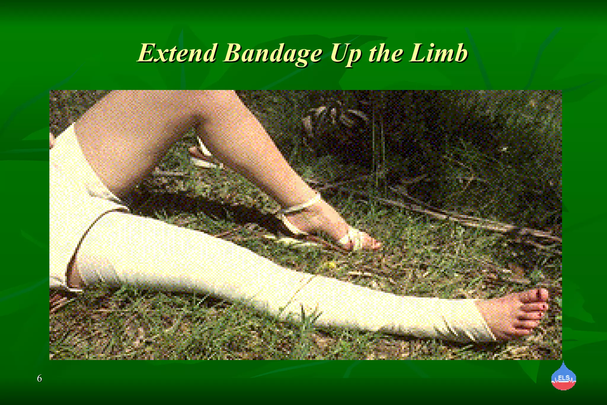 Envenomation of Snake Bites | PPT | First Aid | Injuries