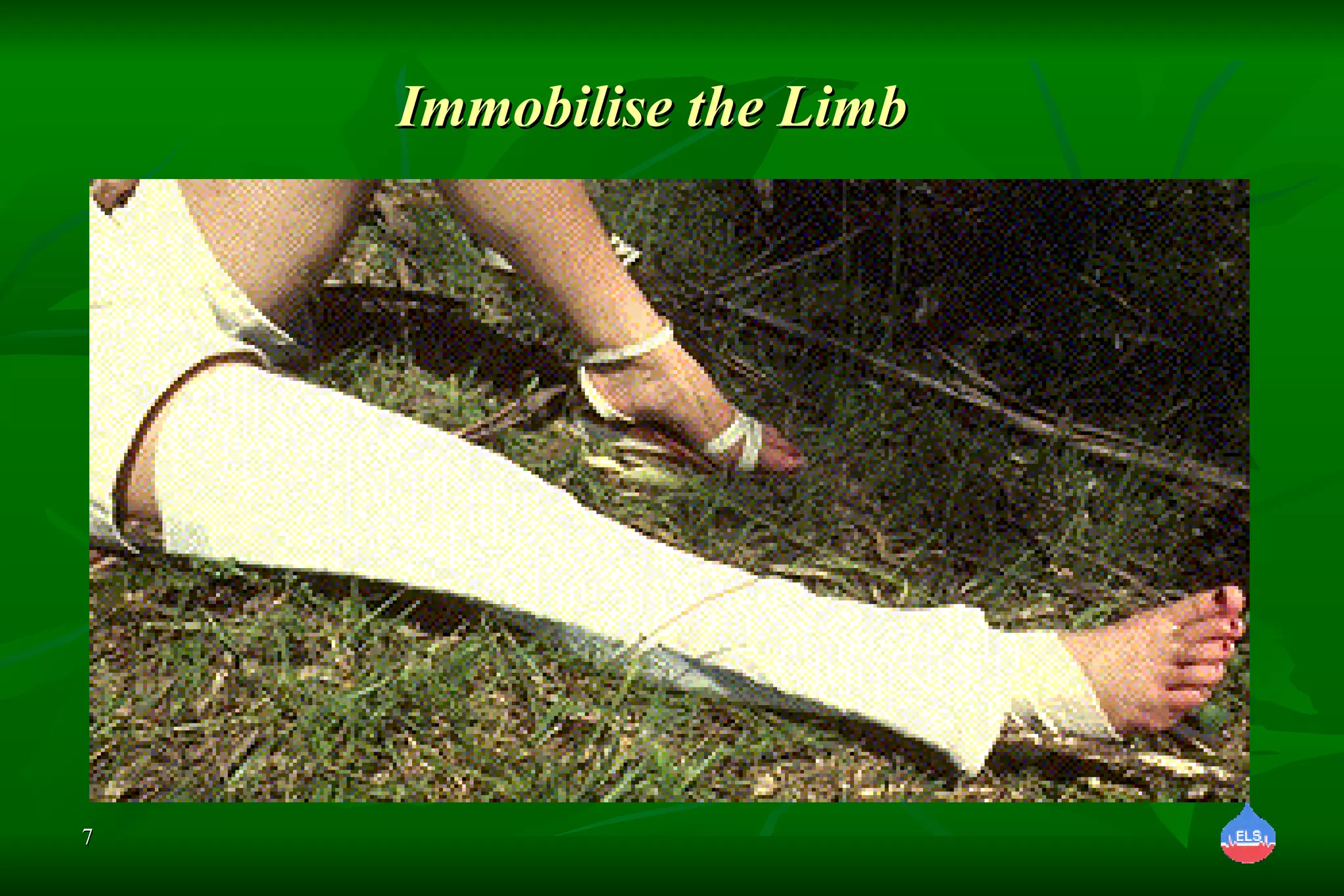 Envenomation of Snake Bites | PPT | First Aid | Injuries