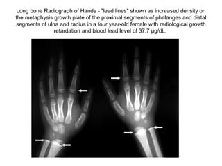 Environmental case lead | PPT