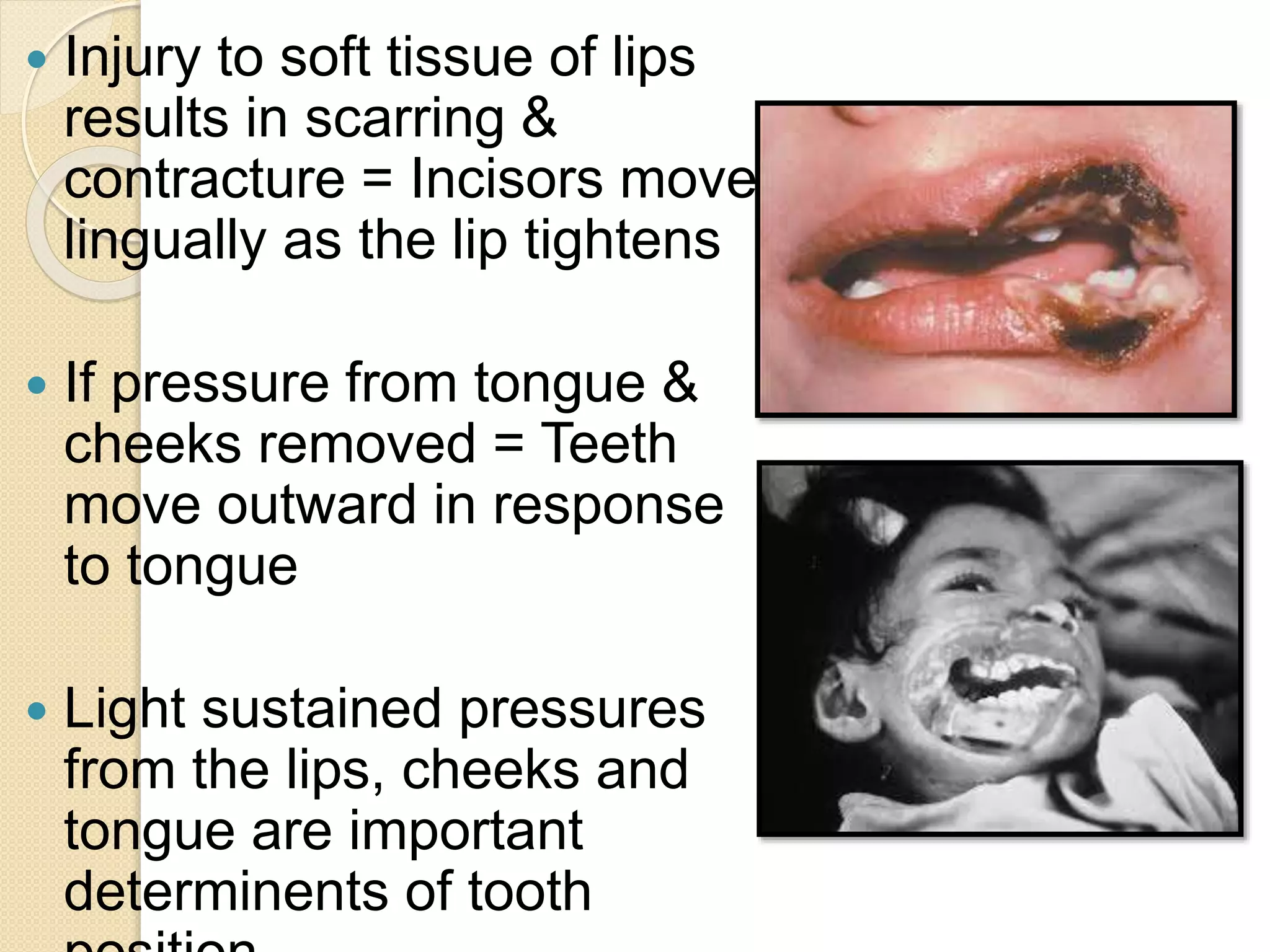 Environmental influences on malocclusion | PPTX
