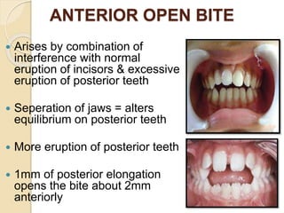 Environmental influences on malocclusion | PPTX
