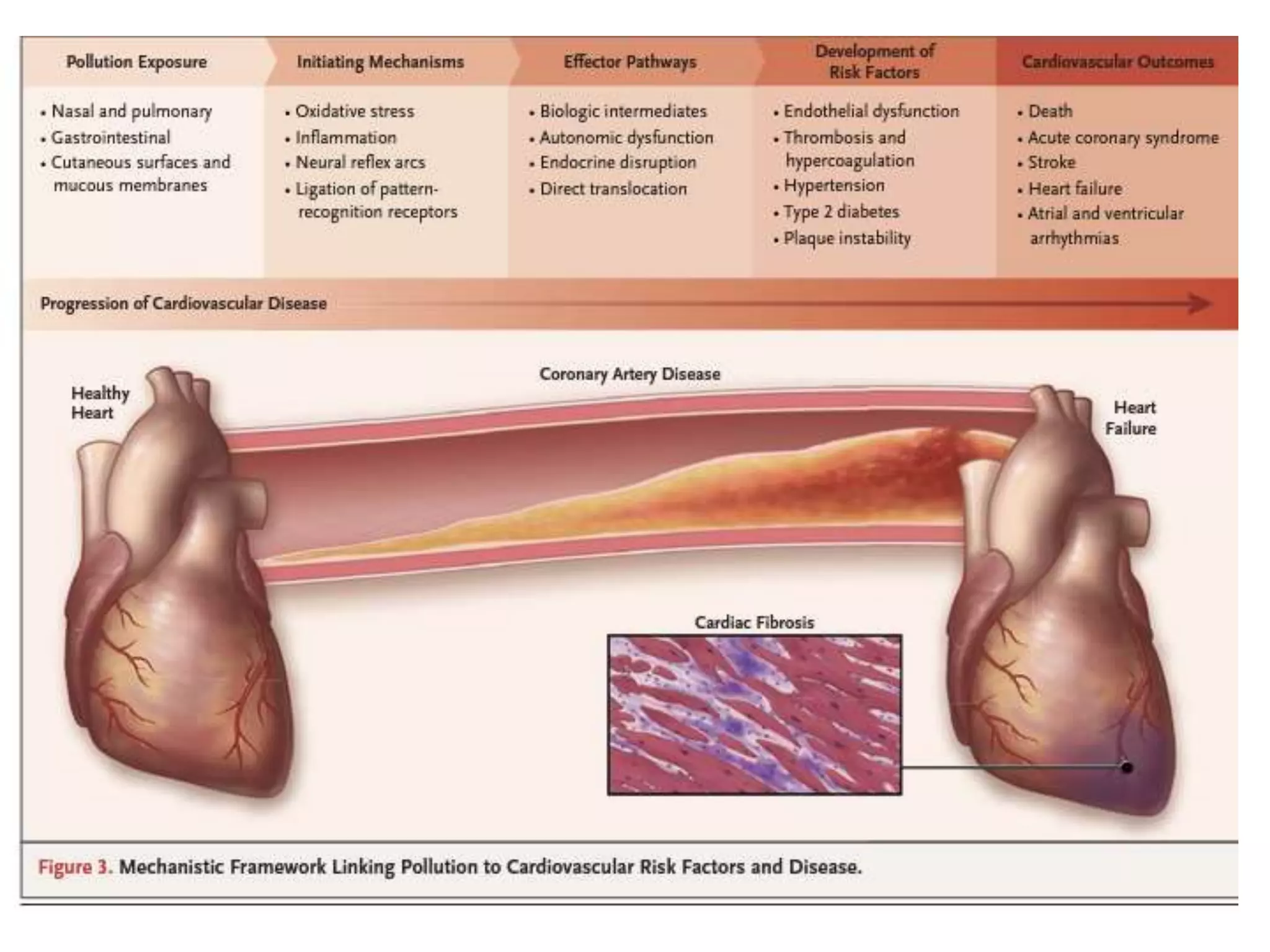 ENVIRONMENT AND CARDIOVASCULAR DISEASE.pptx