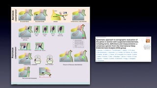 ENZIAN-Endometriosis | PDF