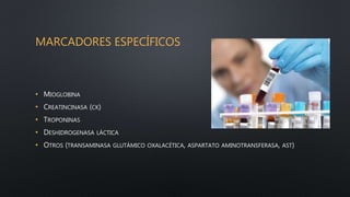 Enzimas cardíacas | PPTX