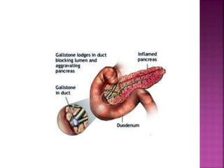Enzim dan Penyakit | PPTX