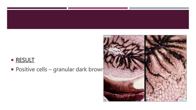 ENZYME HISTOCHEMISTRY.................pptx