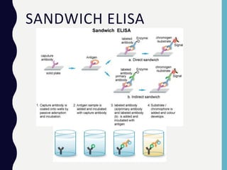 Enzyme linked immunosorbent assay | PPTX