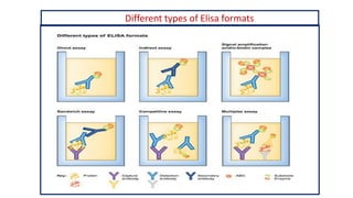 Enzyme linked immunosorbent assay (elisa) and its clinical significance ...