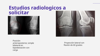 GONARTROSIS_de_rodilla clasificación y manejo | PPTX