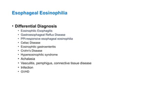 Eosinophilic Esophagitis: Criteria of Diagnosis and Management | PPTX