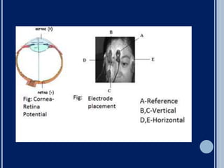 Human Computer Interaction using Eye Gesture Recognition ...