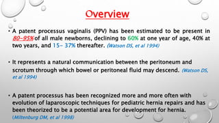Efficacy of laparoscopically assisted high ligation of patent processus ...