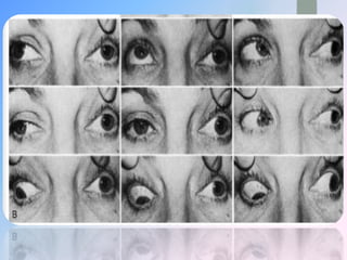 Extraocular Muscles: Anatomy | PPTX