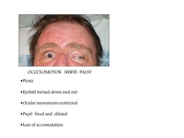 Extra ocular muscles ppt