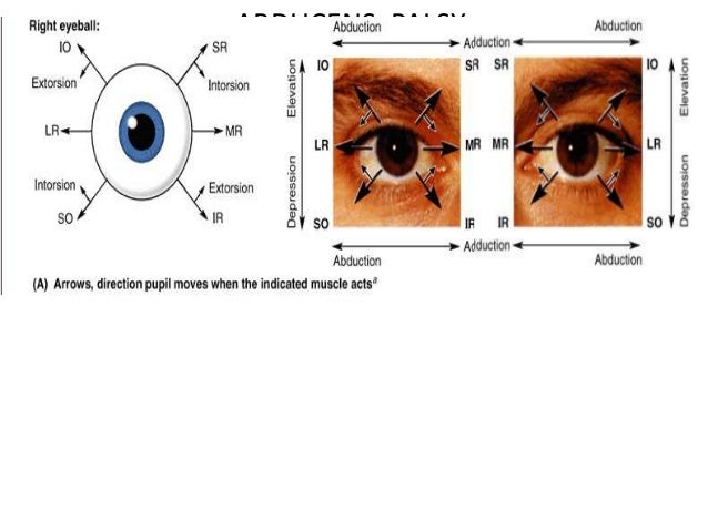 Extra ocular muscles ppt