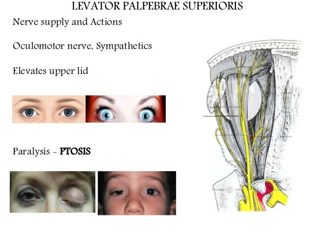 Extra ocular muscles ppt