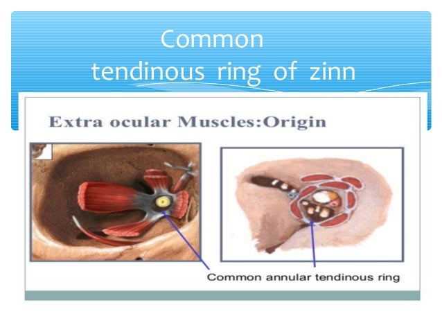 Extra Ocular Motility @Farhana.Islam