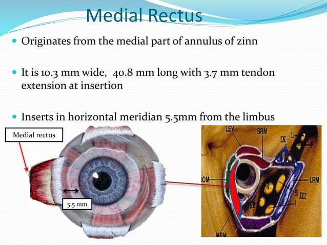 Eom ppt | PPTX | Eye and Vision Conditions | Diseases and Conditions