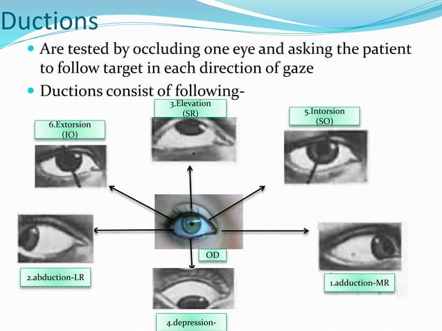 Eom ppt | PPTX | Eye and Vision Conditions | Diseases and Conditions