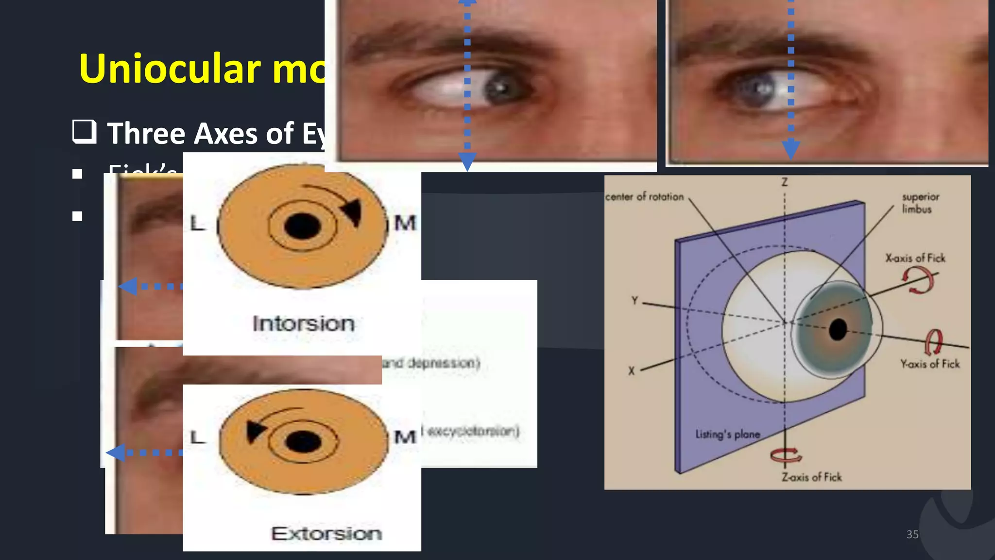 Eoms & ocular motility | PPTX | Eye and Vision Conditions | Diseases ...