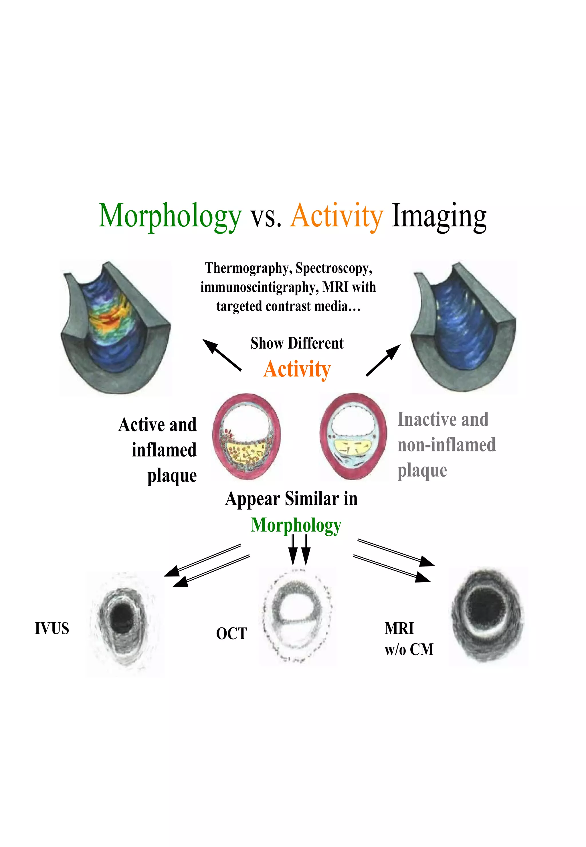 Nir catheter final | PPT