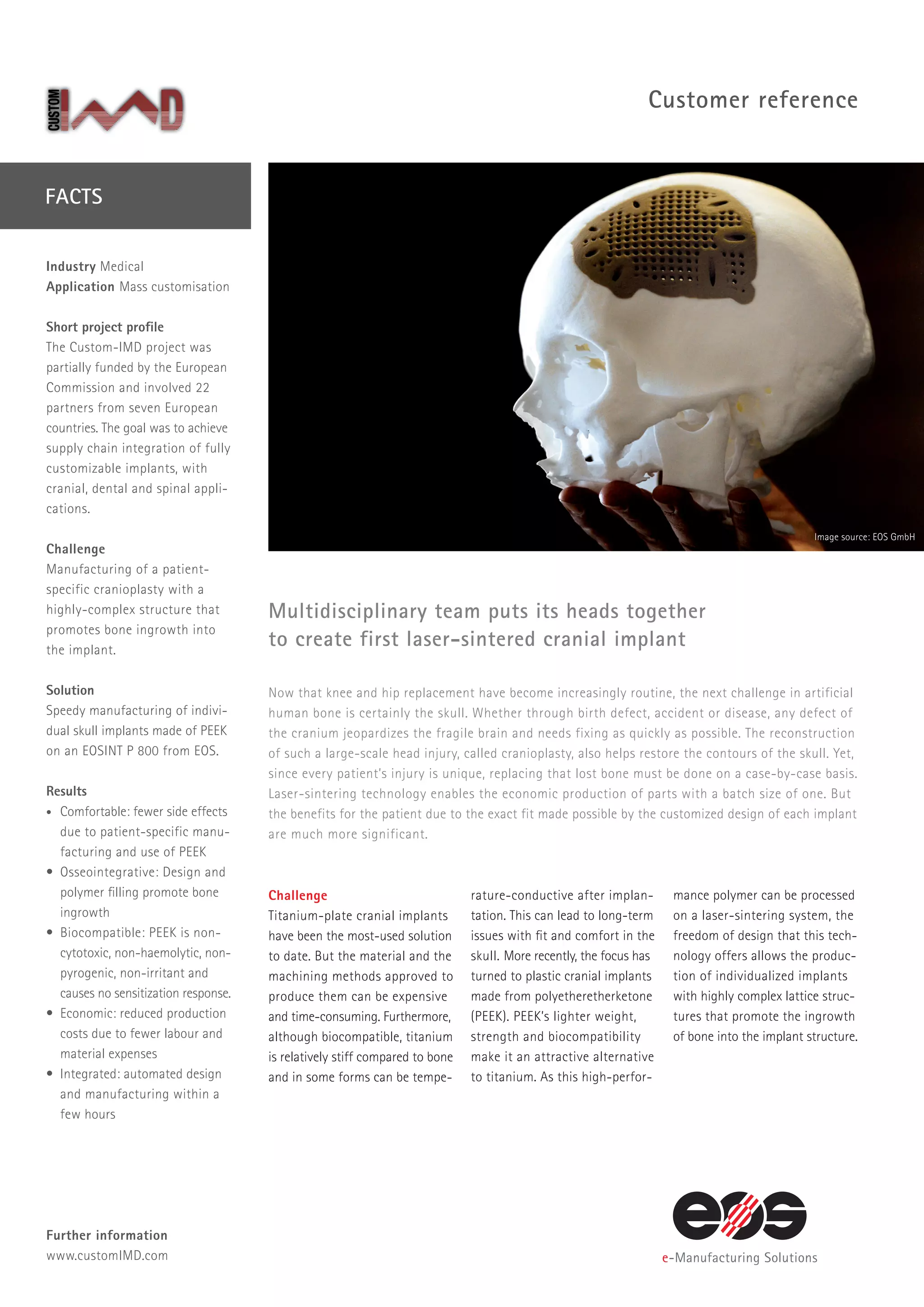 Cranial Implant manufactured with Laser Sintering using EOS Additive ...