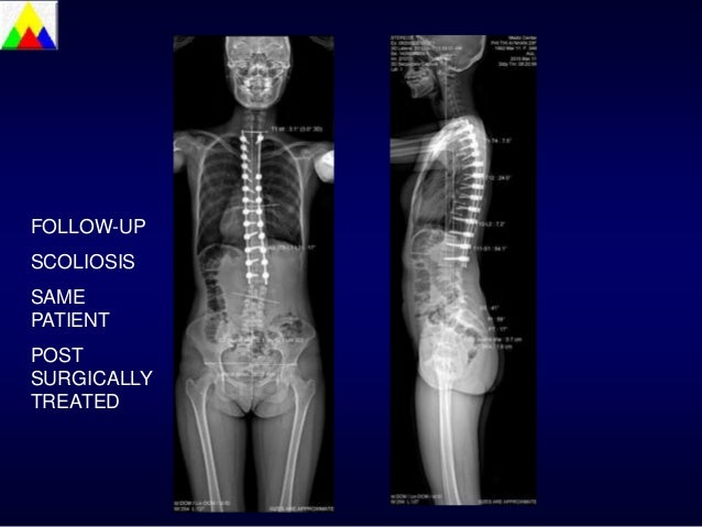 EOS in MEDIC presented in Thailand, Dr NGUYEN VAN CONG, MEDIC MEDICAL…